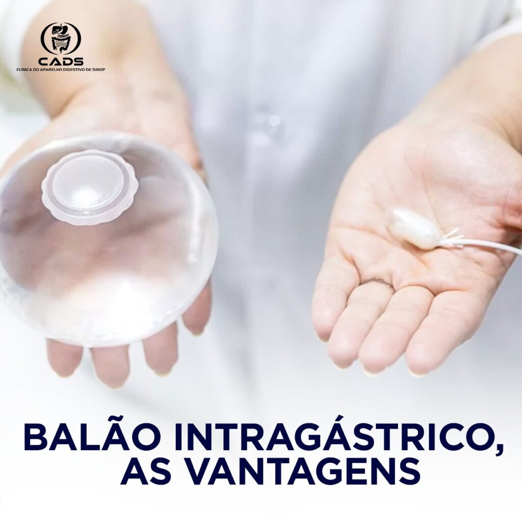 Balão Intragástrico – CADSINOP